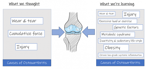 YOUR PHYSIO - Osteoarthritis of the Knee